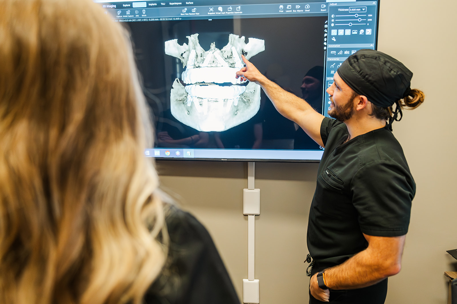 About All-On-X Procedure | Anchored Dental Implants